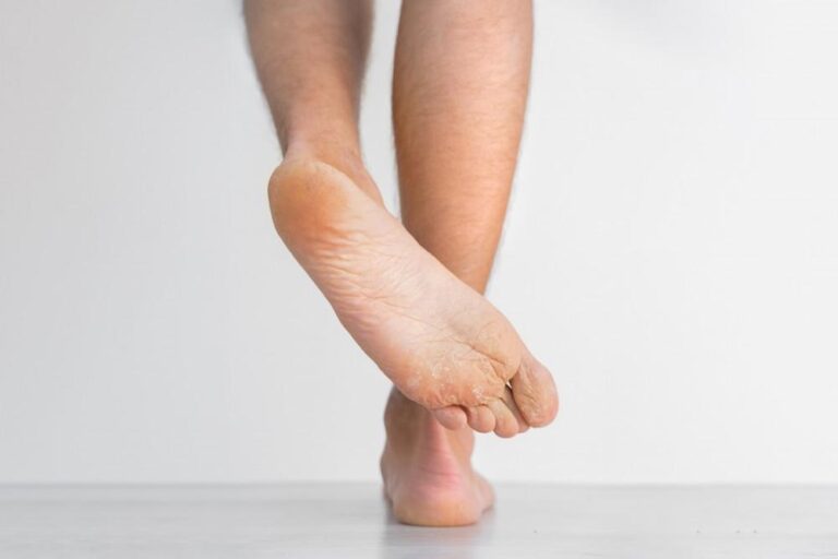 Home Remedies for Plantar Fasciitis Pain – Arizona Foot Health